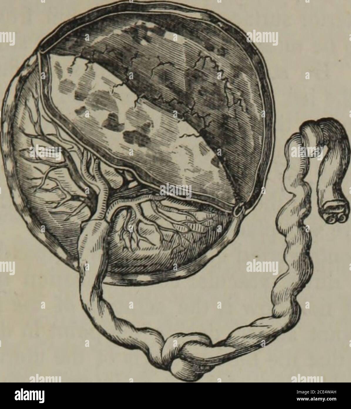 Fallopius hi-res stock photography and images - Alamy