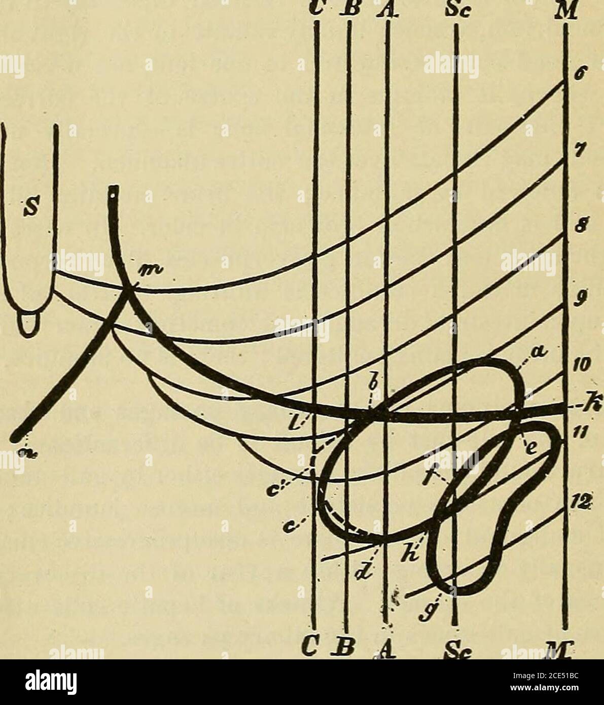 Gall stones biliary calculi hi-res stock photography and images - Alamy