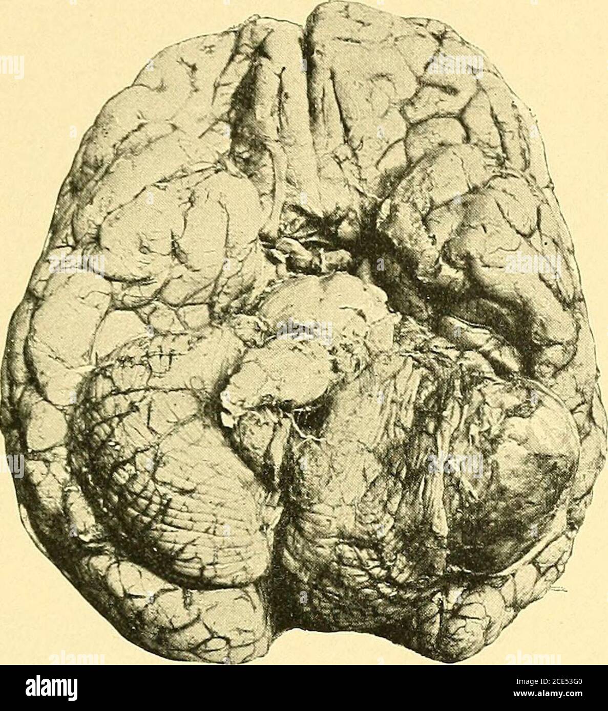 . Some points in the surgery of the brain and its membranes . .—In ...