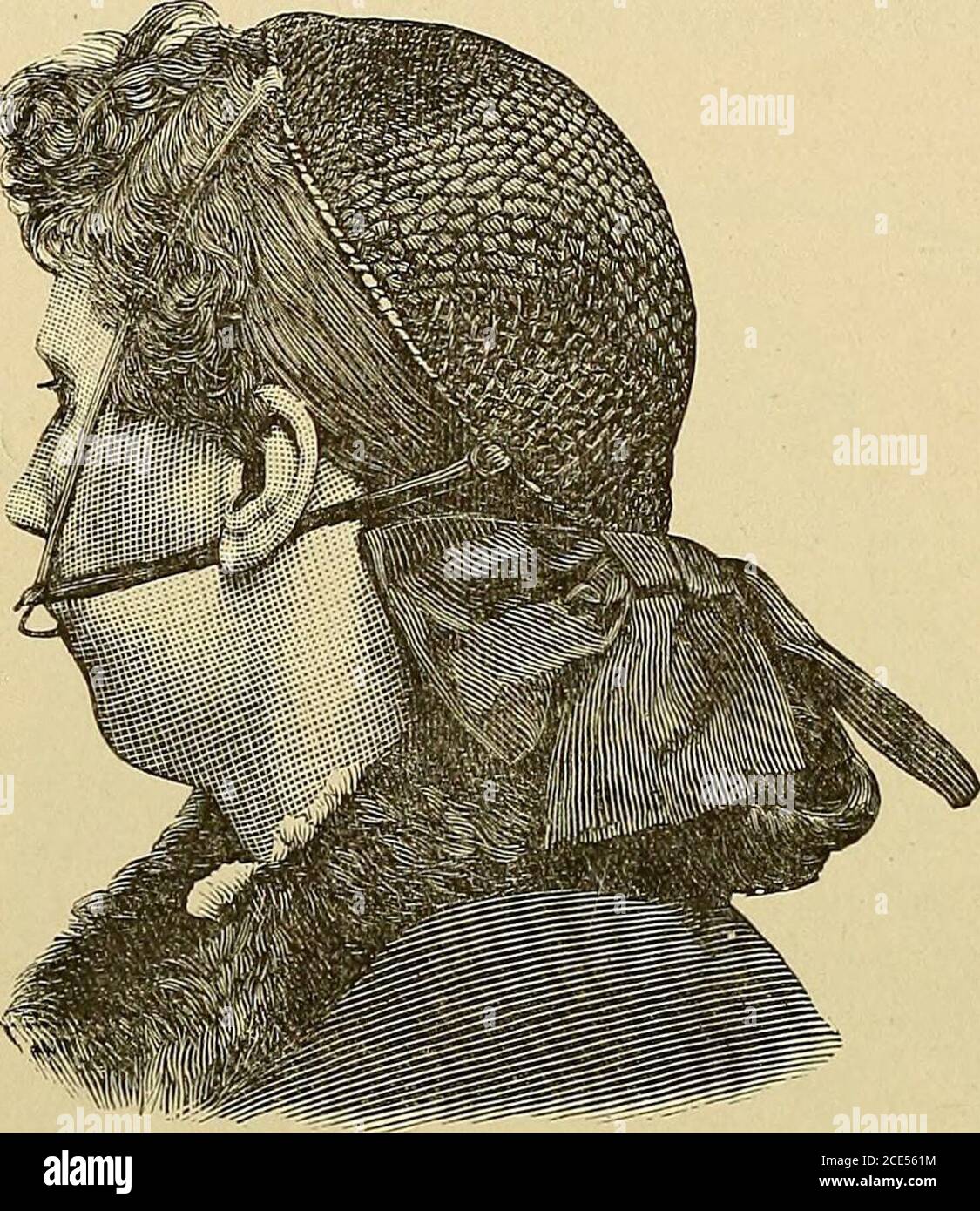 . Orthodontia, or malposition of the human teeth; its prevention and ...