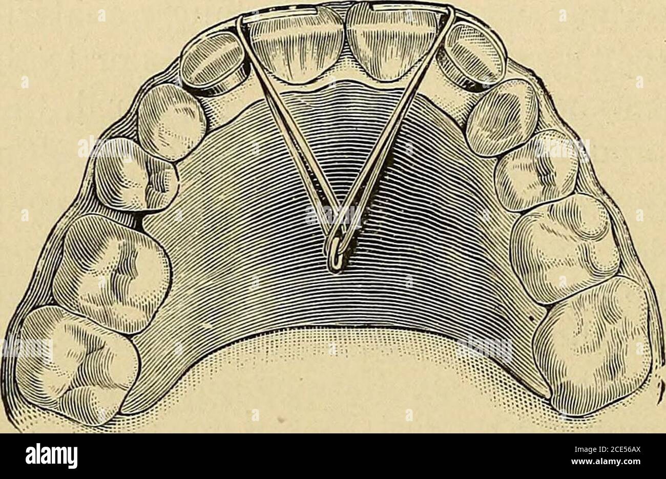 Human teeth superior number of teeth hi-res stock photography and ...