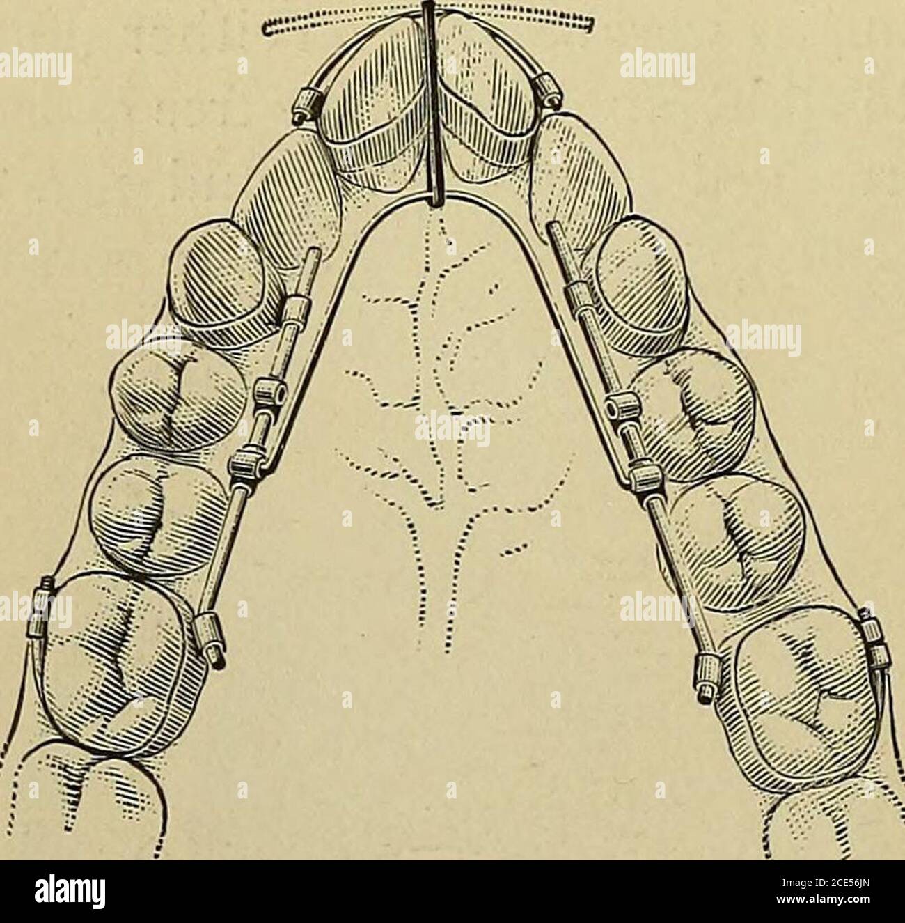 . Orthodontia, or malposition of the human teeth; its prevention and ...