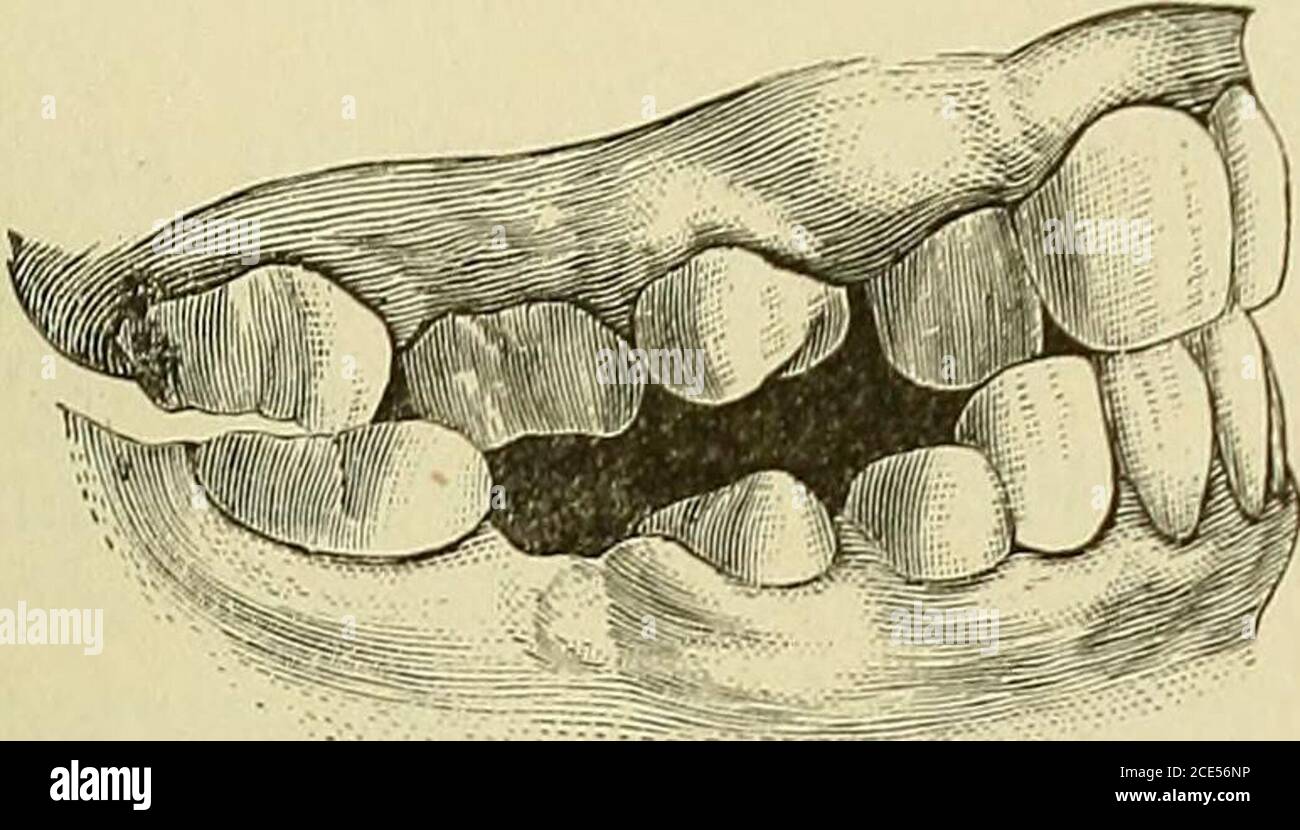 . Orthodontia, or malposition of the human teeth; its prevention and ...