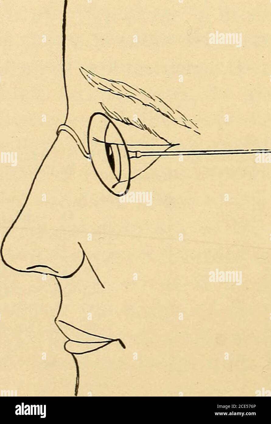 . Spectacles and eyeglasses, their forms, mounting, and proper ...