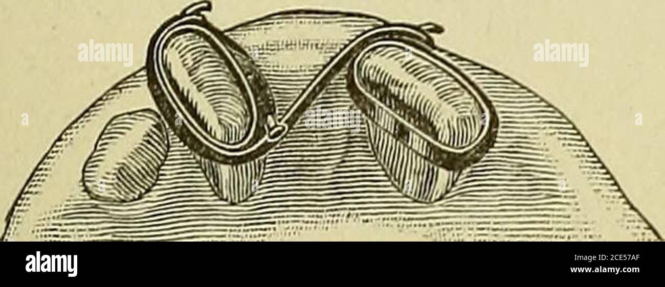 . Orthodontia, or malposition of the human teeth; its prevention and ...