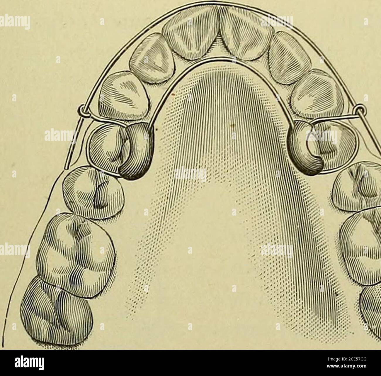 . Orthodontia, or malposition of the human teeth; its prevention and ...