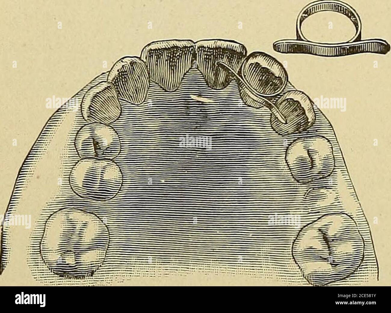 . Orthodontia, or malposition of the human teeth; its prevention and ...