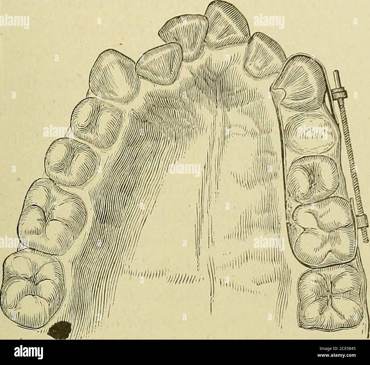 . Orthodontia, or malposition of the human teeth; its prevention and ...