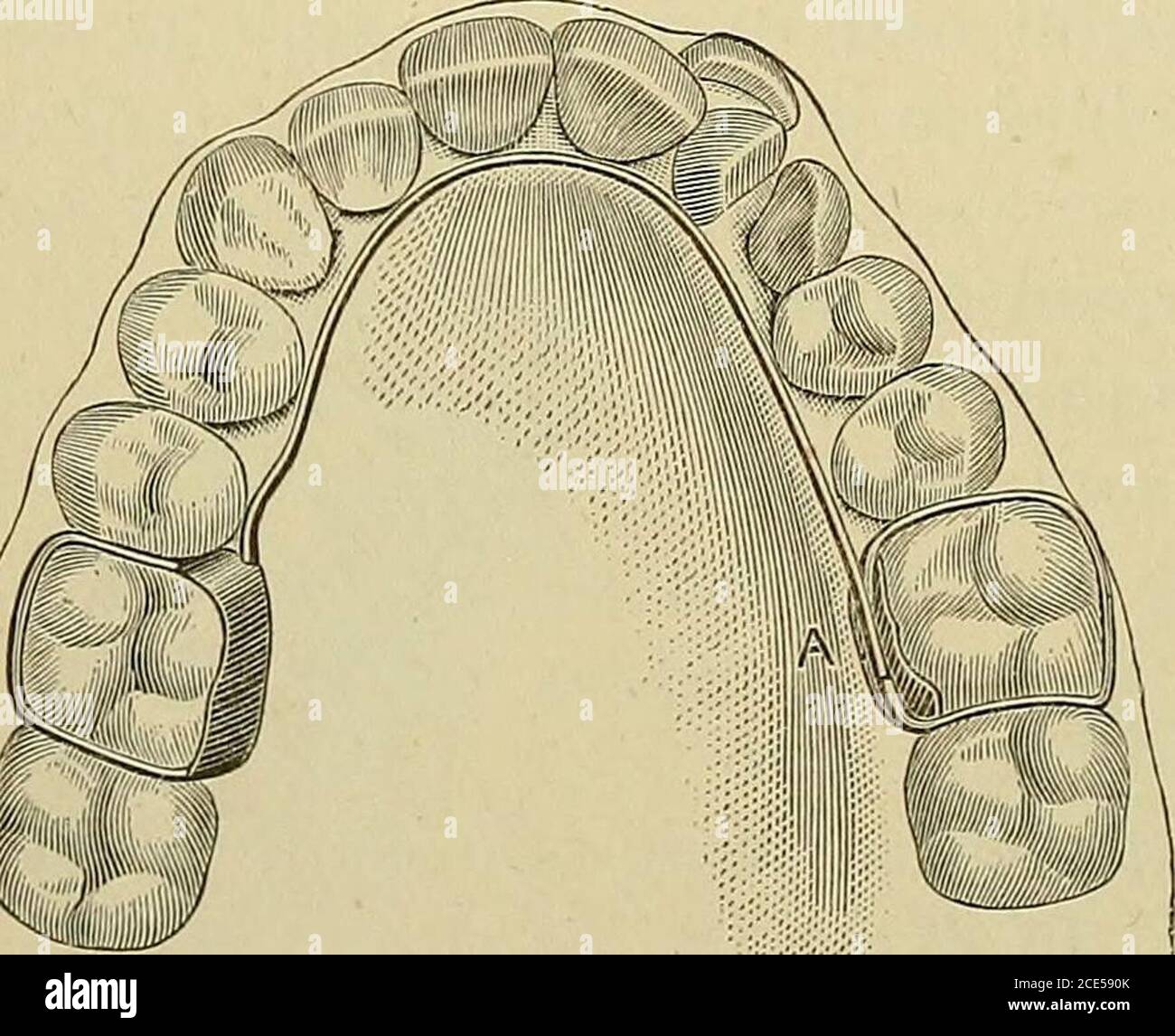 . Orthodontia, or malposition of the human teeth; its prevention and ...