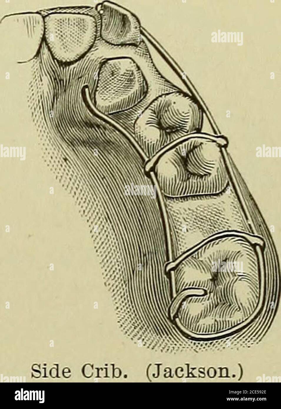 . Orthodontia, or malposition of the human teeth; its prevention and ...
