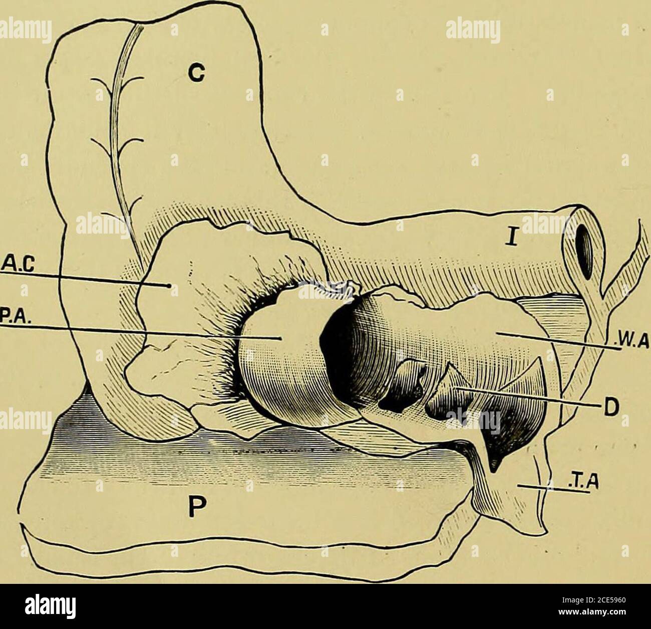 . A contribution to the pathology of the vermiform appendix . p. 361. 2 ...