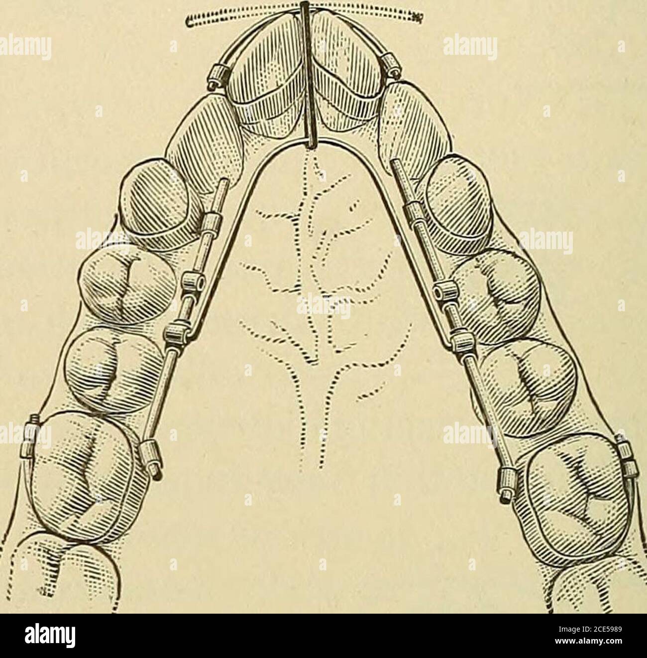 Avoids human hi-res stock photography and images - Alamy