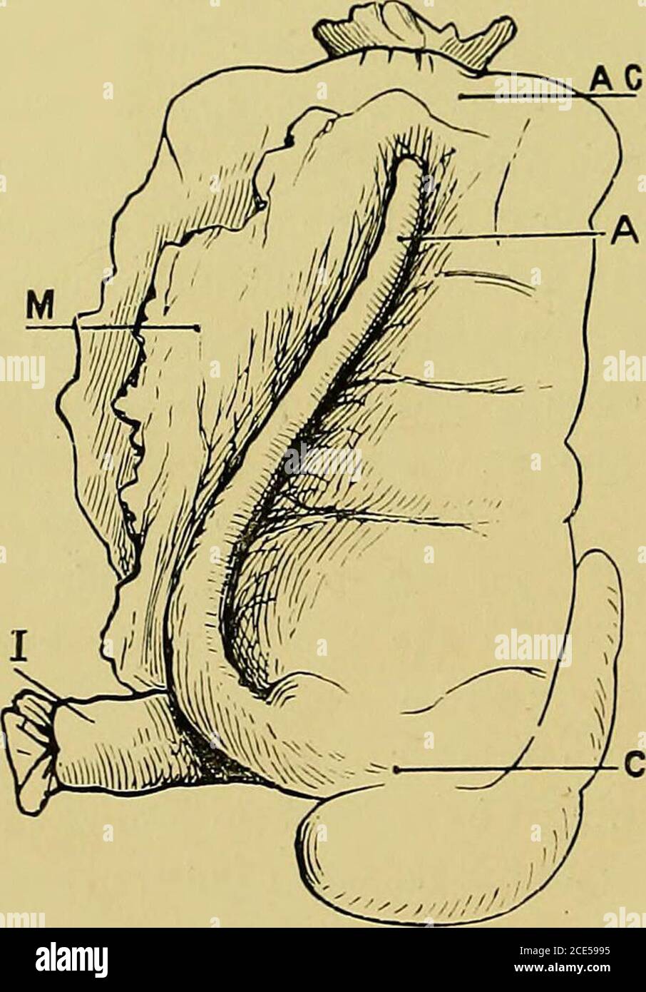 Appendix Location Variation