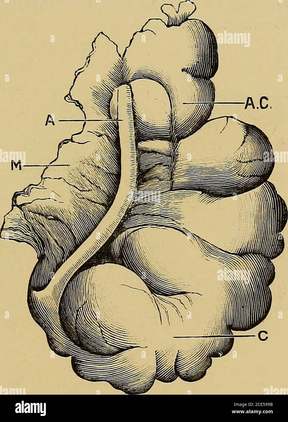 . A contribution to the pathology of the vermiform appendix . so-colon ...