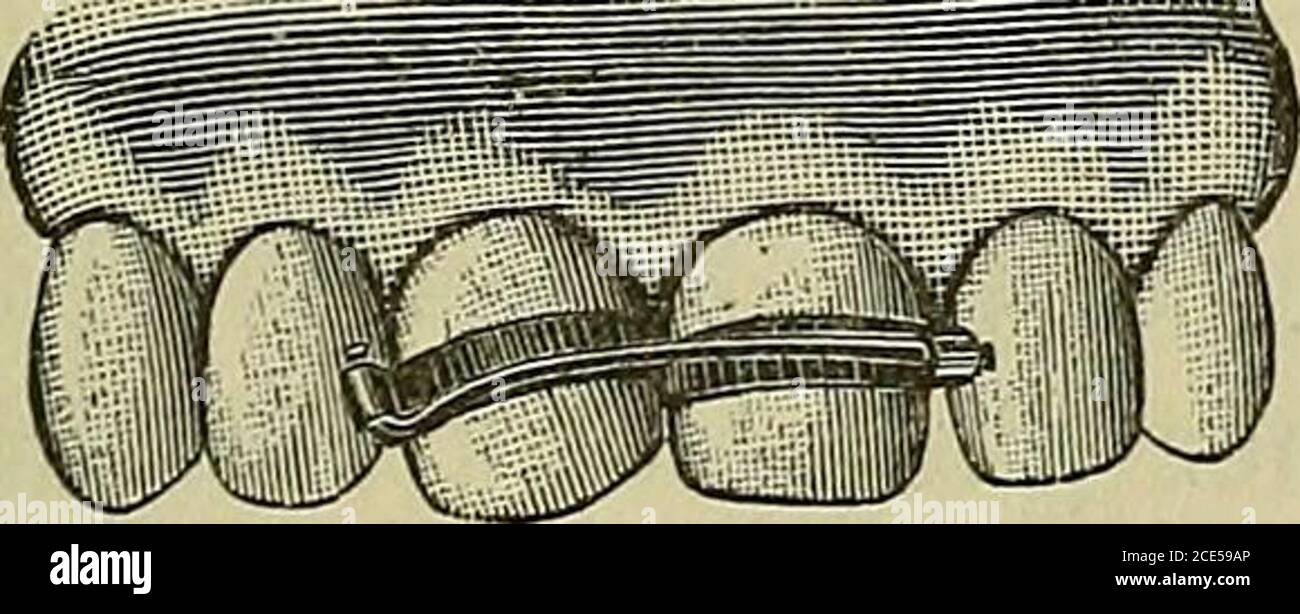 . Orthodontia, or malposition of the human teeth; its prevention and ...