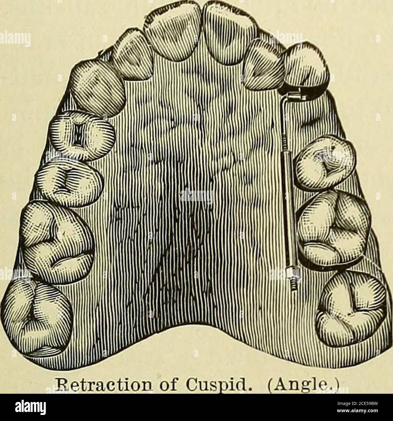 . Orthodontia, or malposition of the human teeth; its prevention and ...