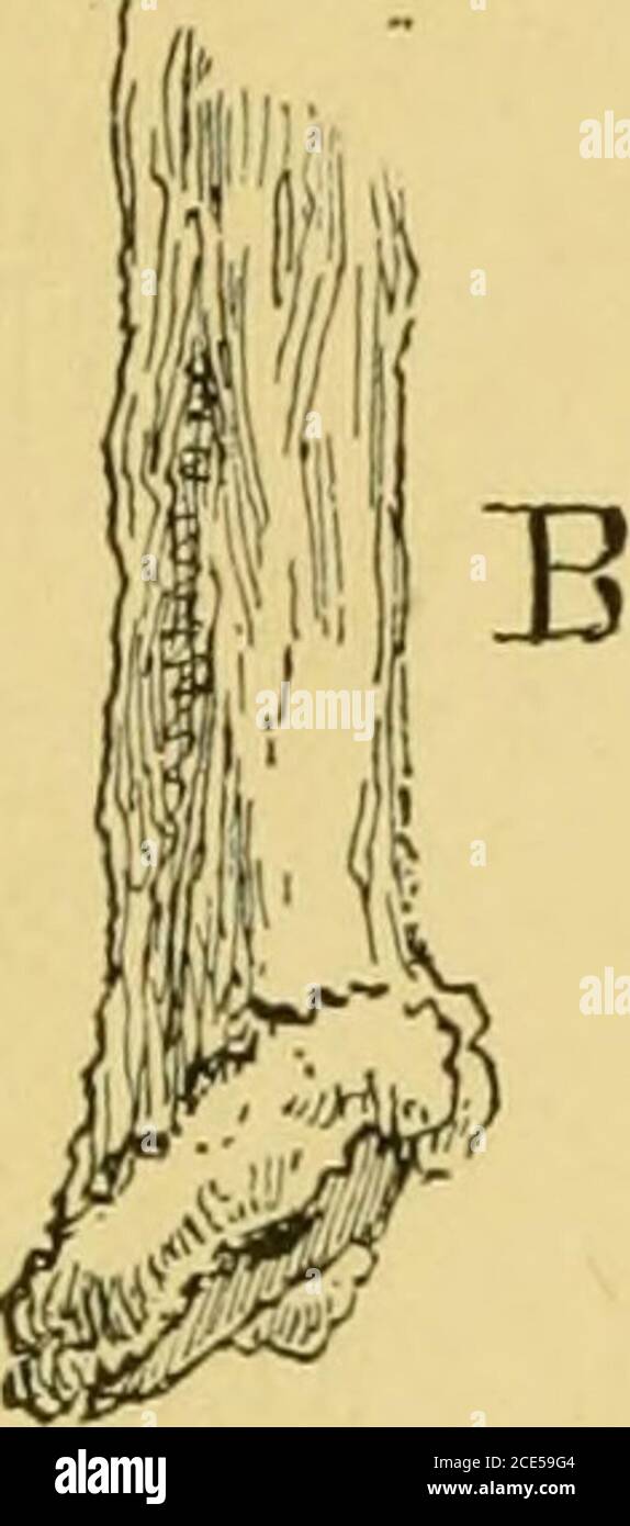 Callus formation hi-res stock photography and images - Alamy
