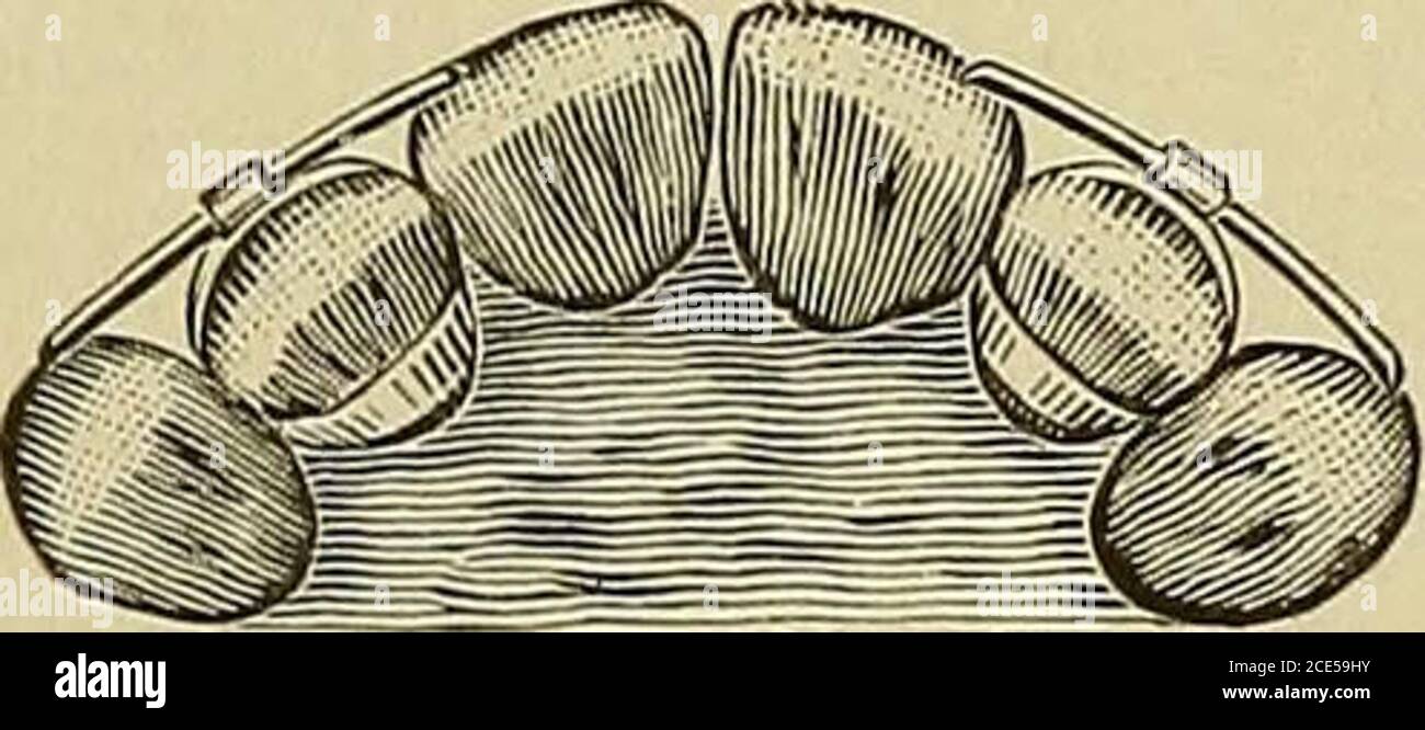 . Orthodontia, or malposition of the human teeth; its prevention and ...