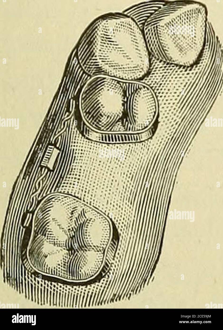 . Orthodontia, or malposition of the human teeth; its prevention and ...