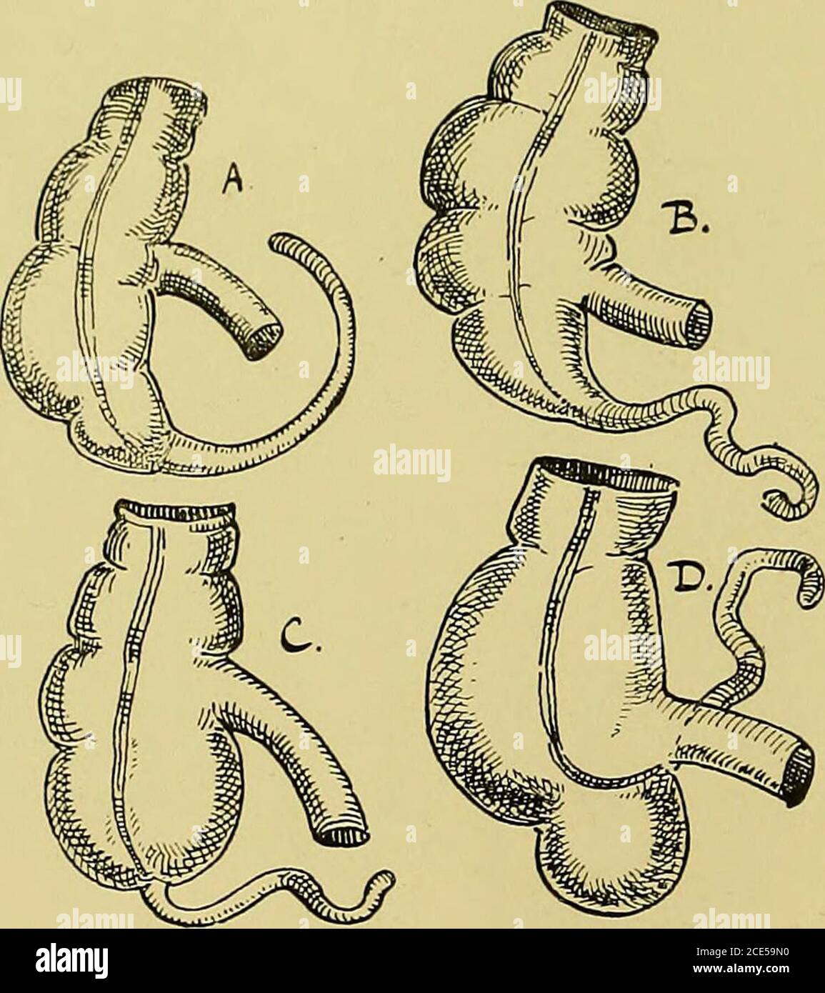 Booksubjectappendicitis hi-res stock photography and images - Alamy