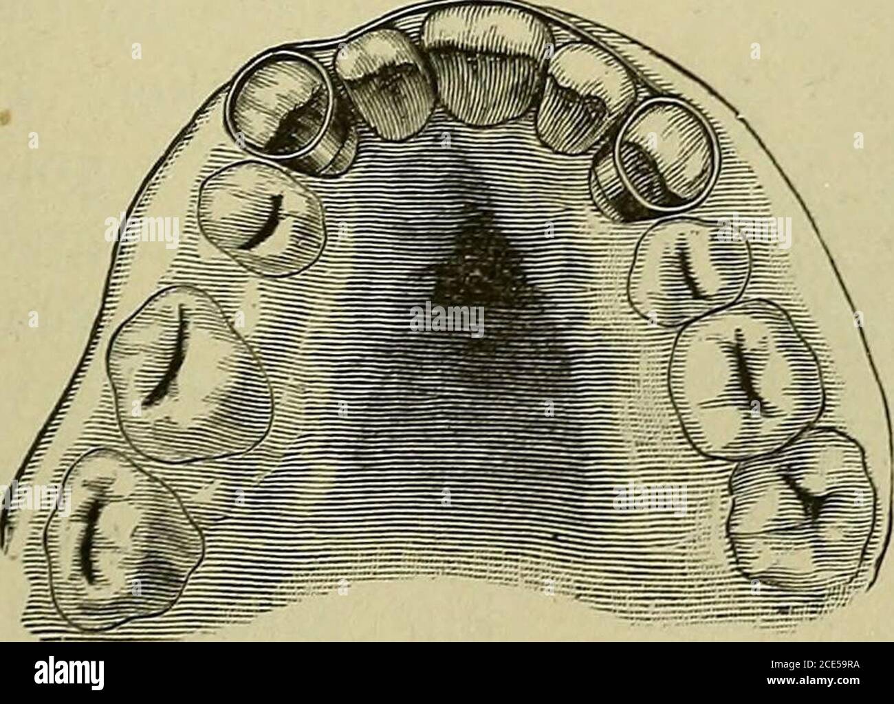 . Orthodontia, or malposition of the human teeth; its prevention and ...
