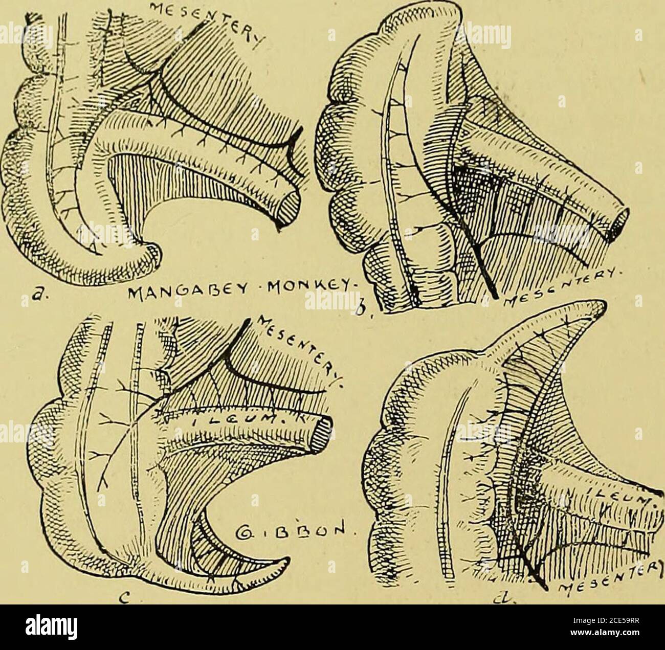 Appendicite hi-res stock photography and images - Alamy
