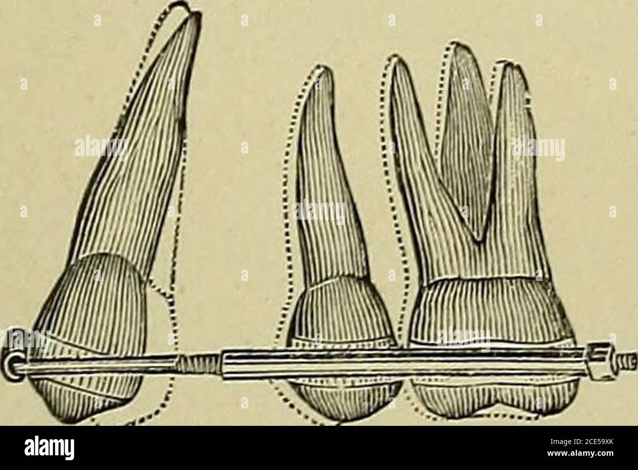 . Orthodontia, or malposition of the human teeth; its prevention and ...
