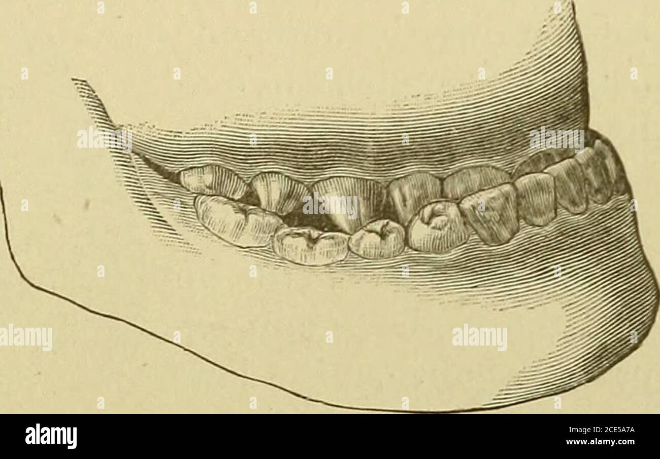 . Orthodontia, or malposition of the human teeth; its prevention and ...