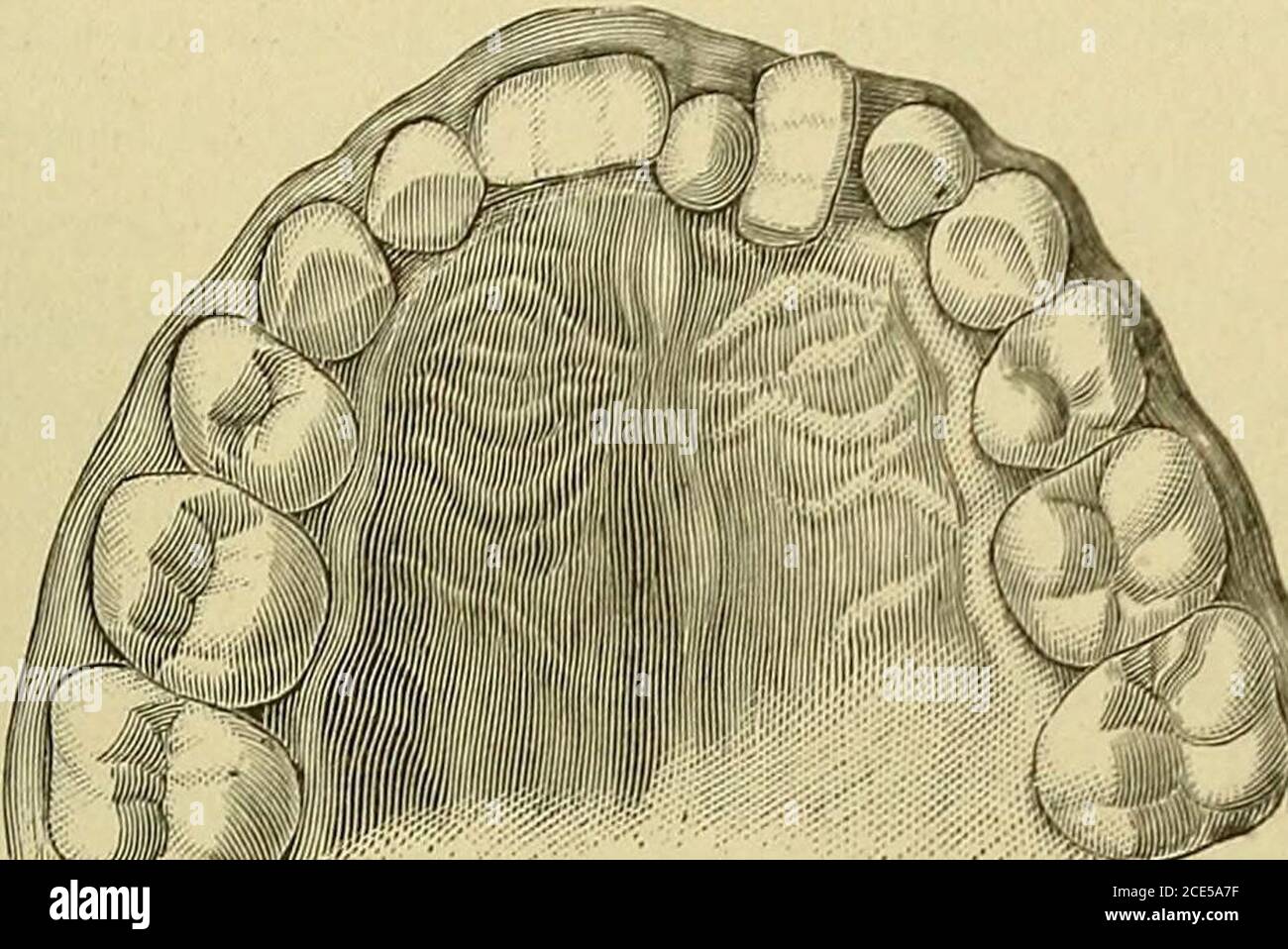 Supernumerary teeth hi-res stock photography and images - Alamy