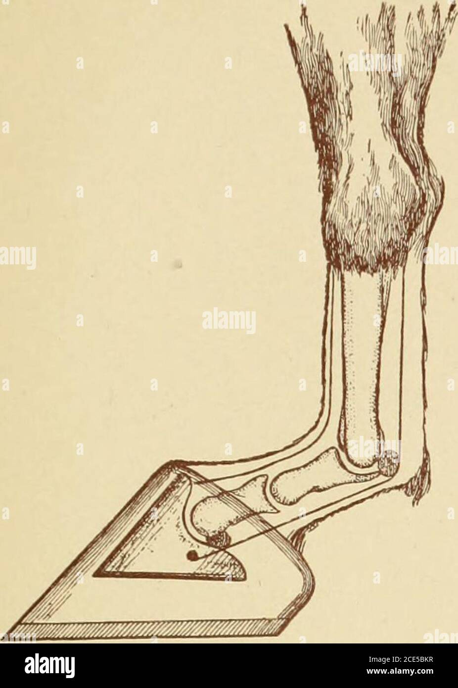 Unbalanced feet hi-res stock photography and images - Alamy