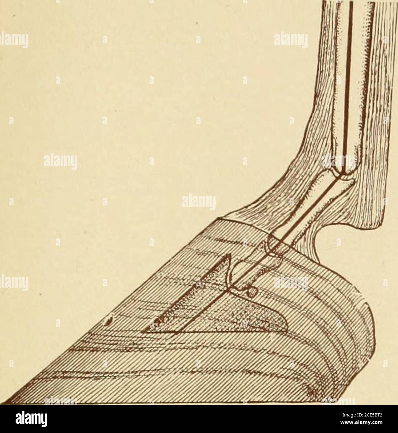 Unbalanced feet hi-res stock photography and images - Alamy