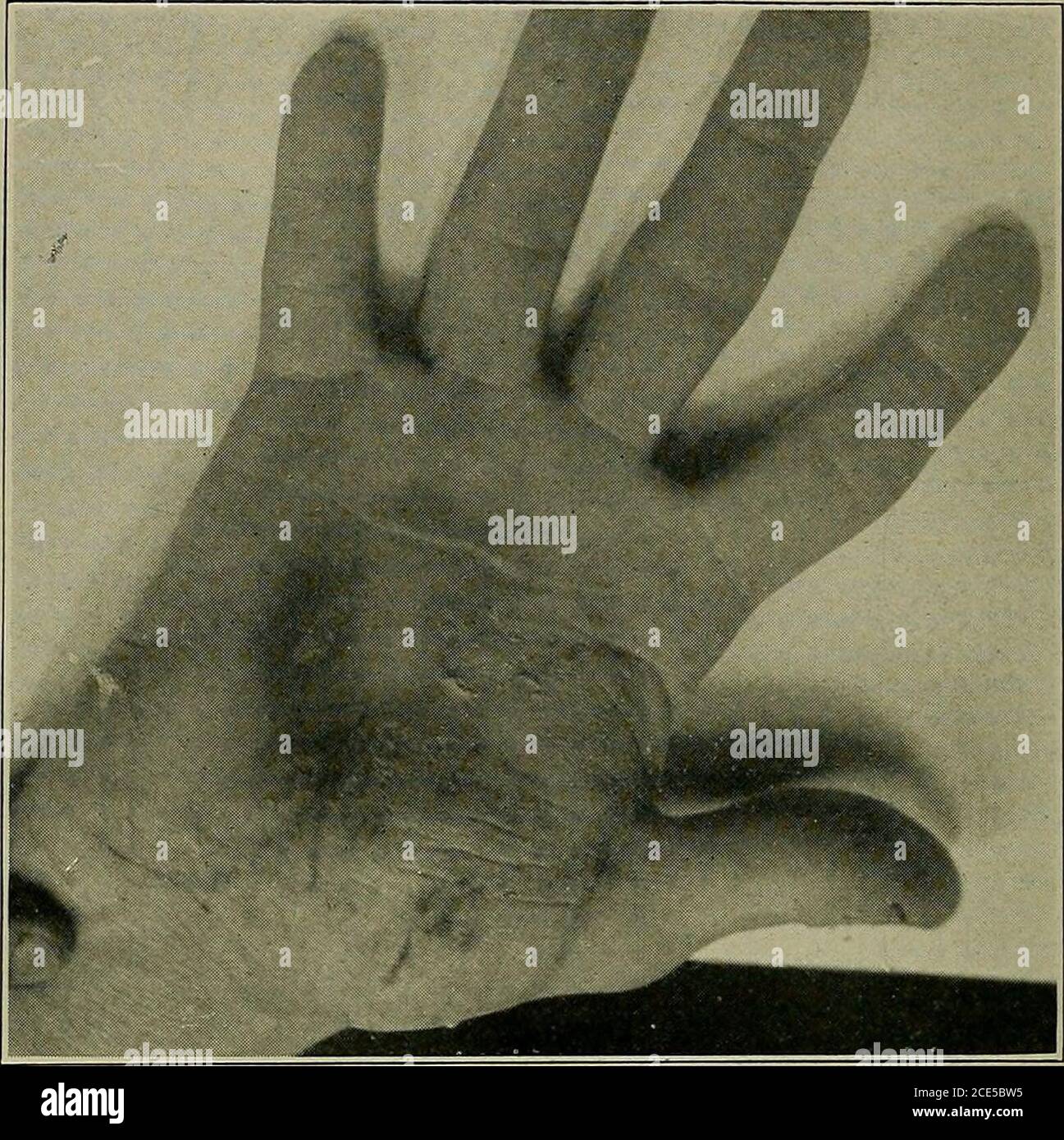 Arsphenamine hi-res stock photography and images - Alamy