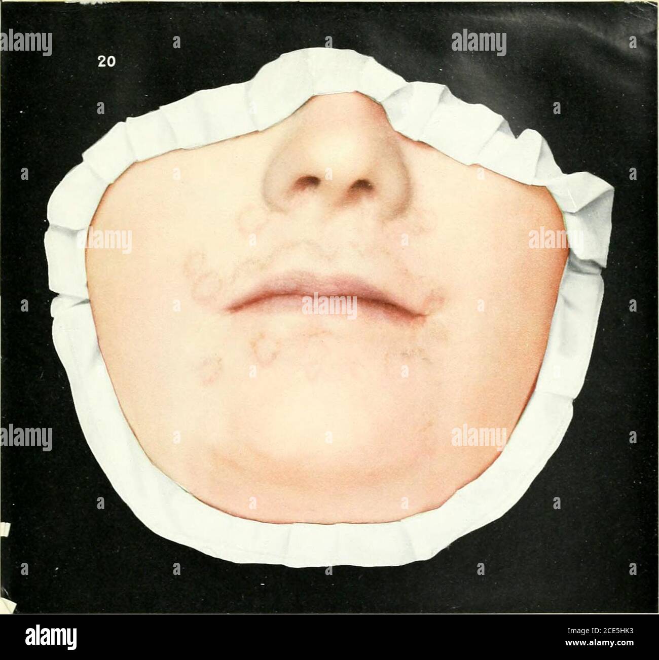 . Diseases of the mouth; for physicians, dentists, medical and dental ...