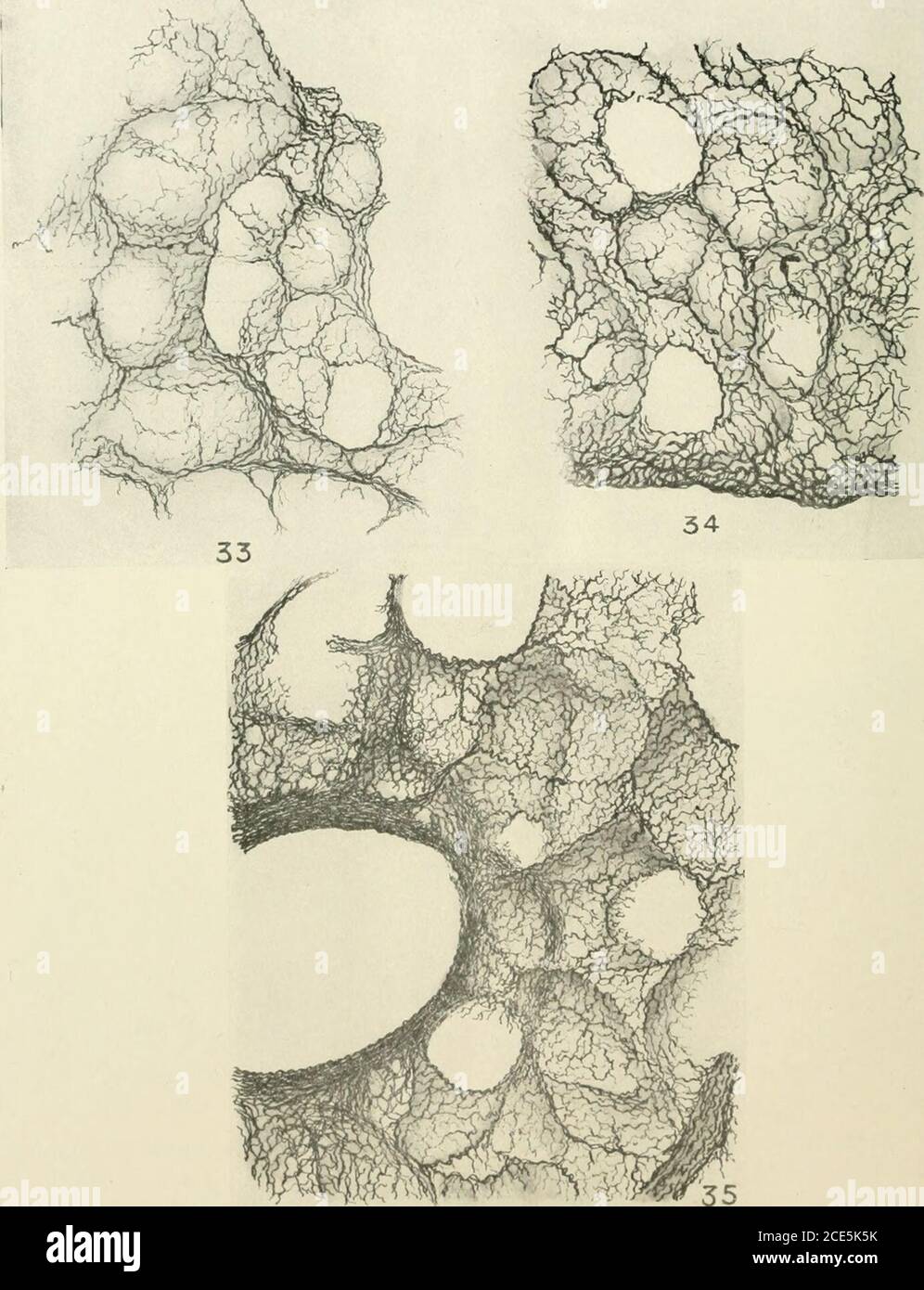 Reticular fibers hi-res stock photography and images - Alamy