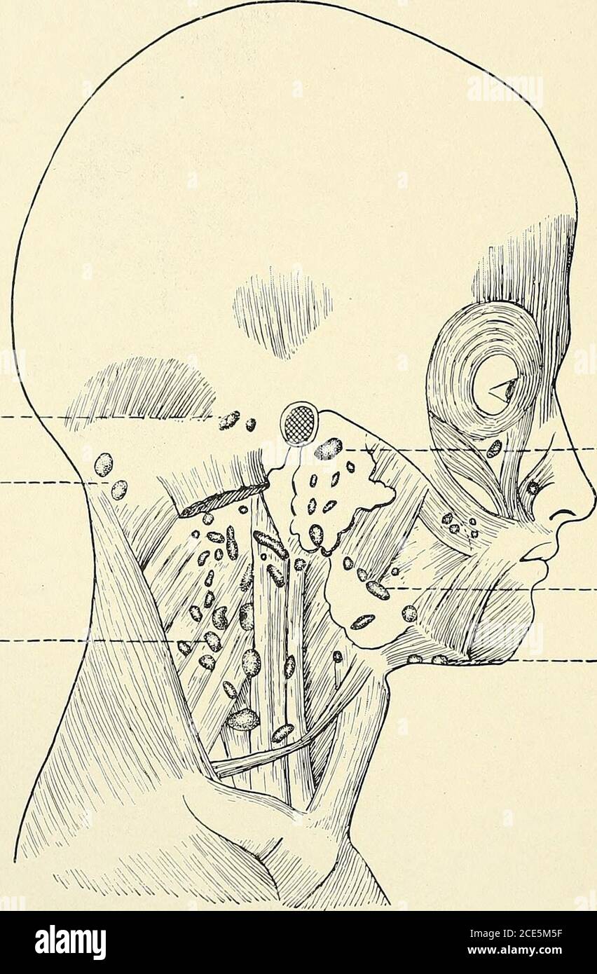 Maxillary Veins High Resolution Stock Photography and Images - Alamy