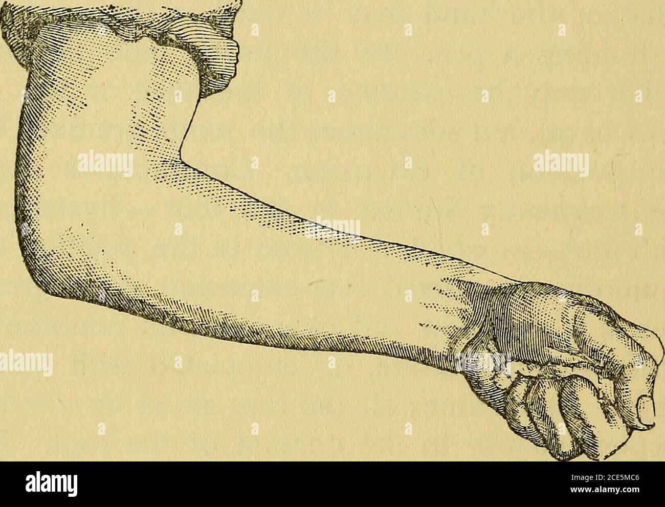 Plegia High Resolution Stock Photography and Images - Alamy