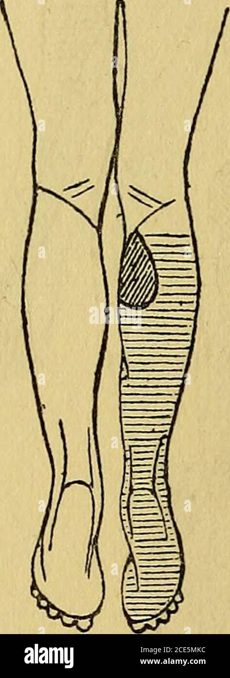 Plantar reflex hi-res stock photography and images - Alamy