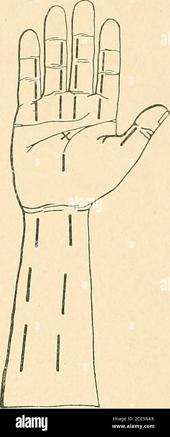 . American practice of surgery ; a complete system of the science and ...