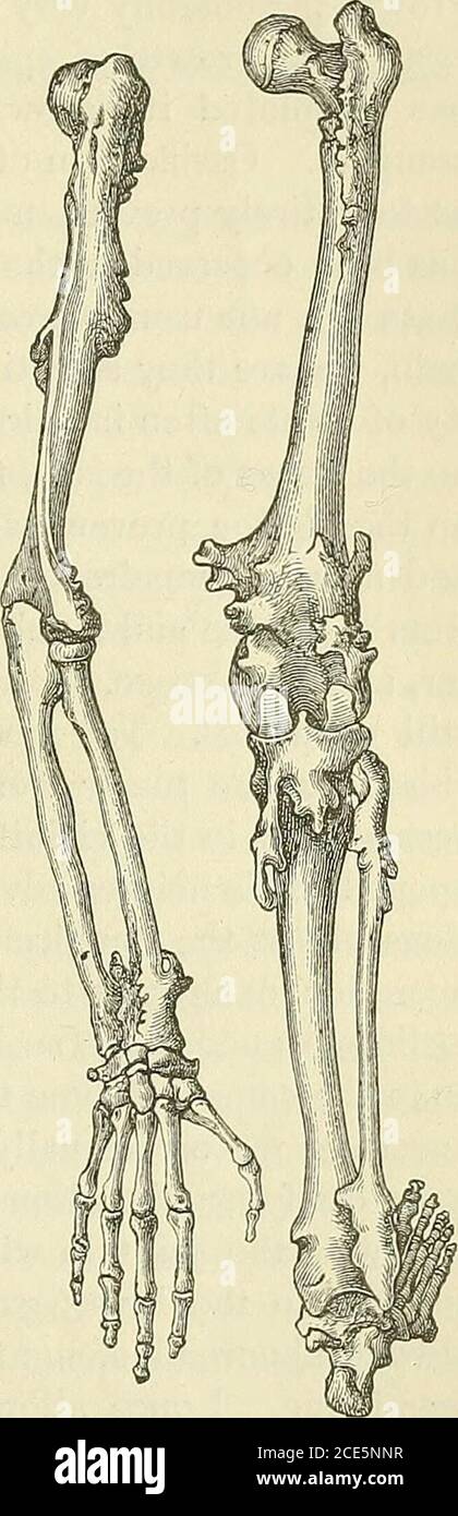 Osteomata hi-res stock photography and images - Alamy