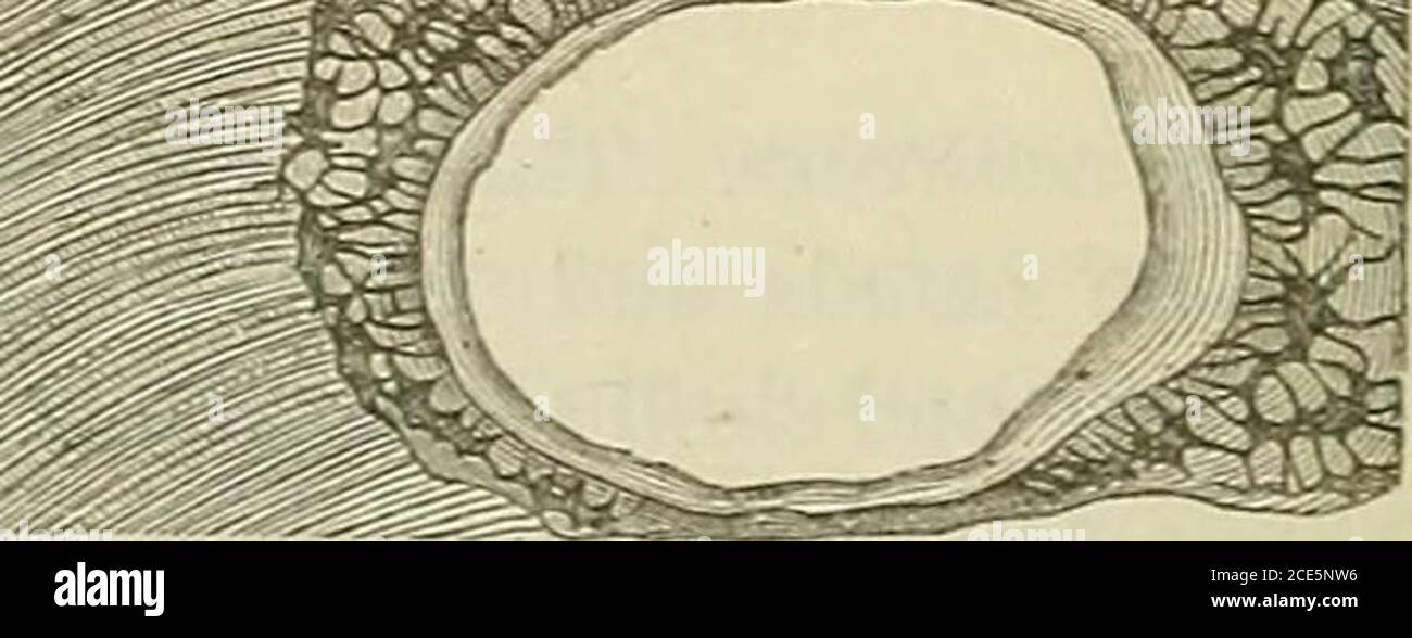 . General surgical pathology and therapeutics, in fifty-one lectures ...