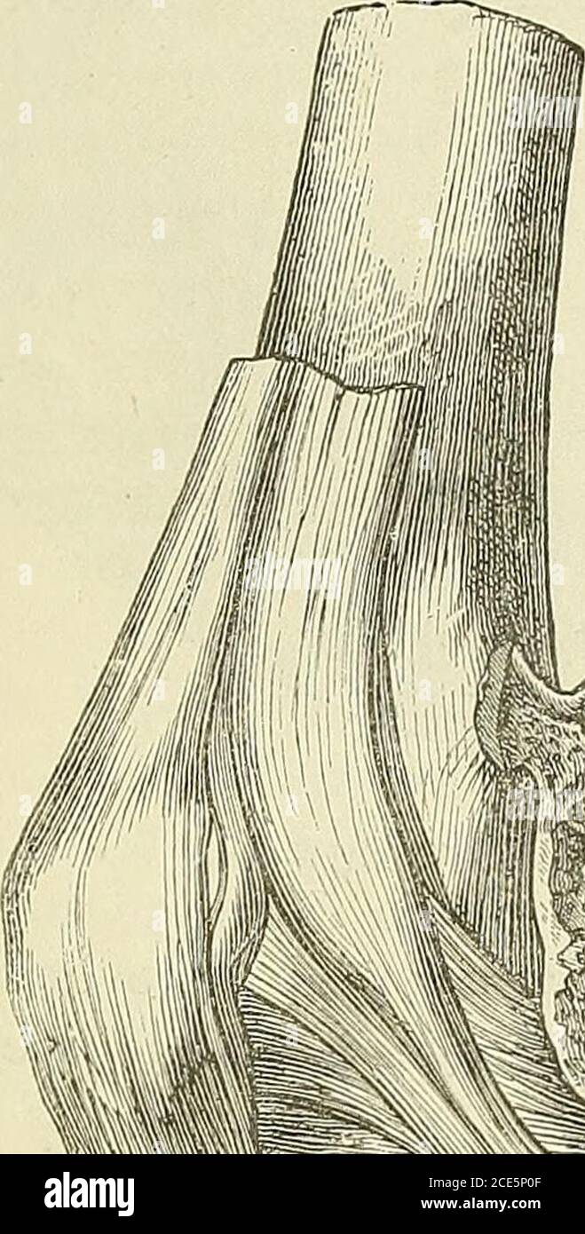 Osteomata hi-res stock photography and images - Alamy