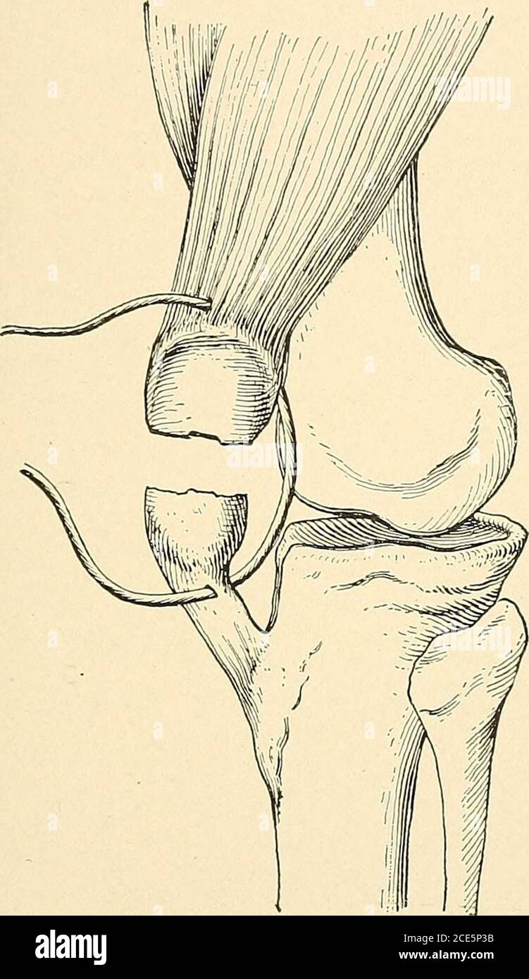 . American practice of surgery ; a complete system of the science and ...
