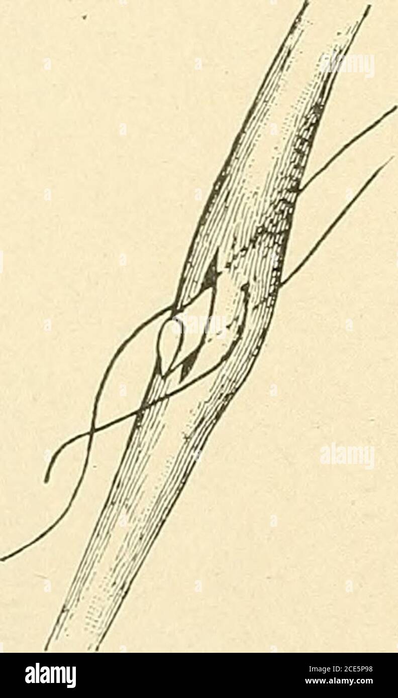 . American practice of surgery ; a complete system of the science and ...