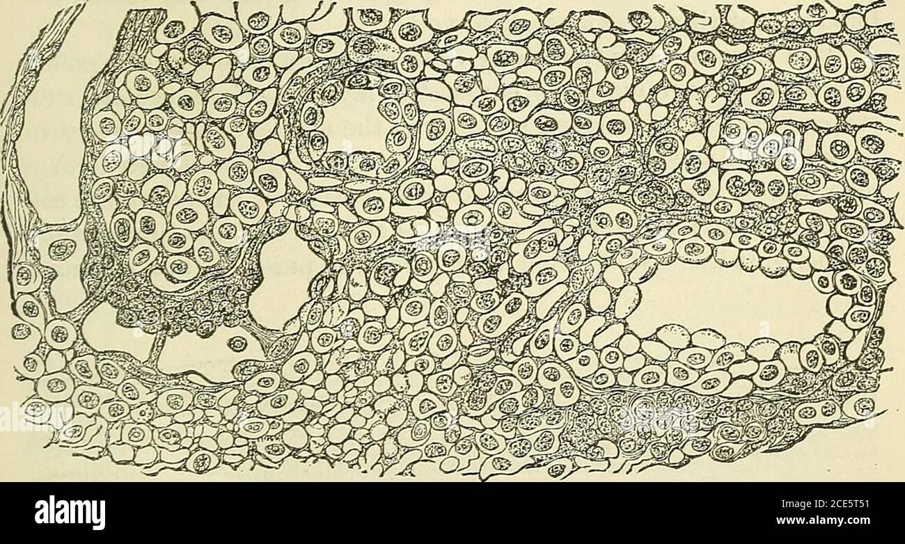 . General surgical pathology and therapeutics, in fifty-one lectures ...