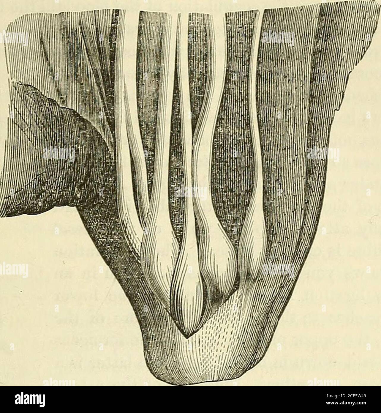 Ligature injury hi-res stock photography and images - Alamy