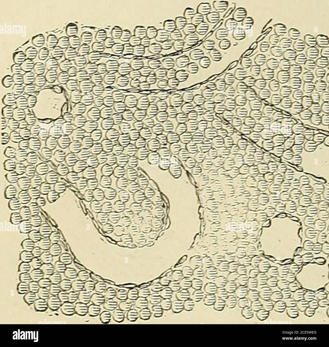 Granulation tissue wound hi-res stock photography and images - Alamy