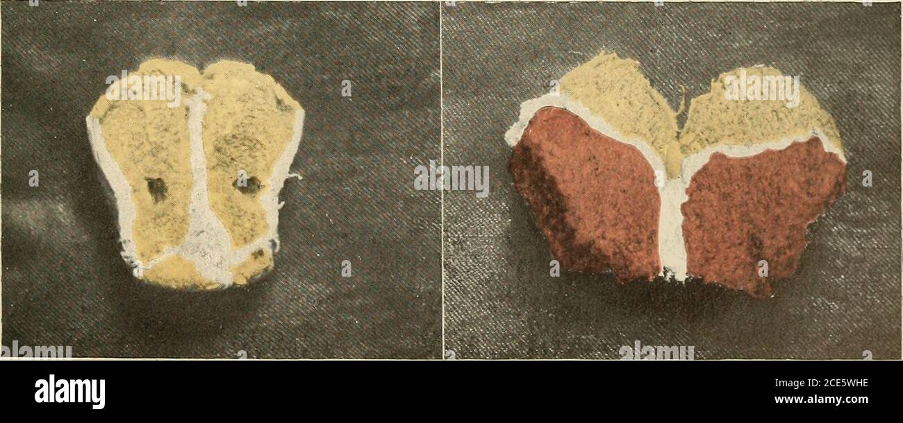 . American practice of surgery ; a complete system of the science and ...