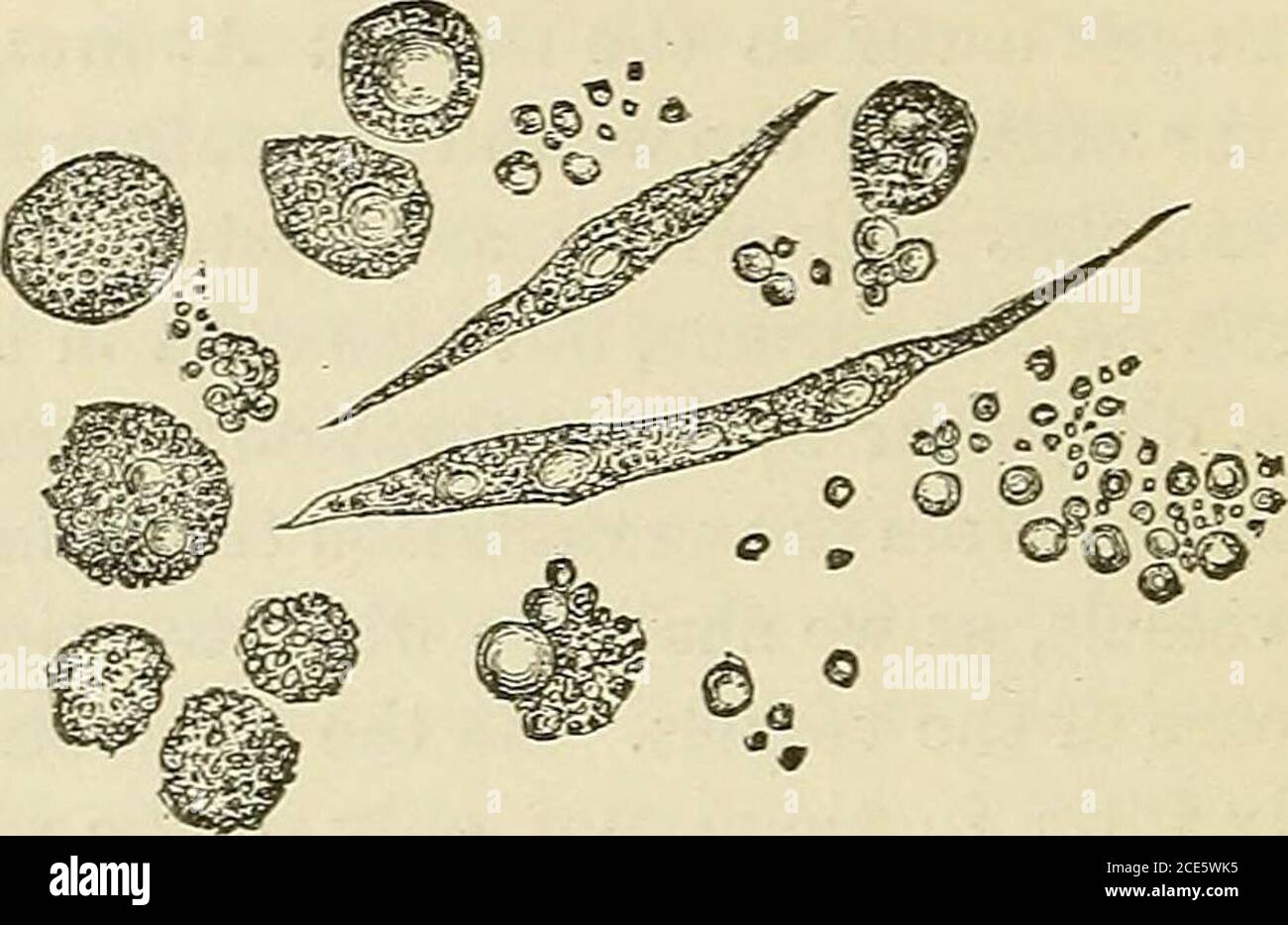 Pus Cells High Resolution Stock Photography and Images - Alamy