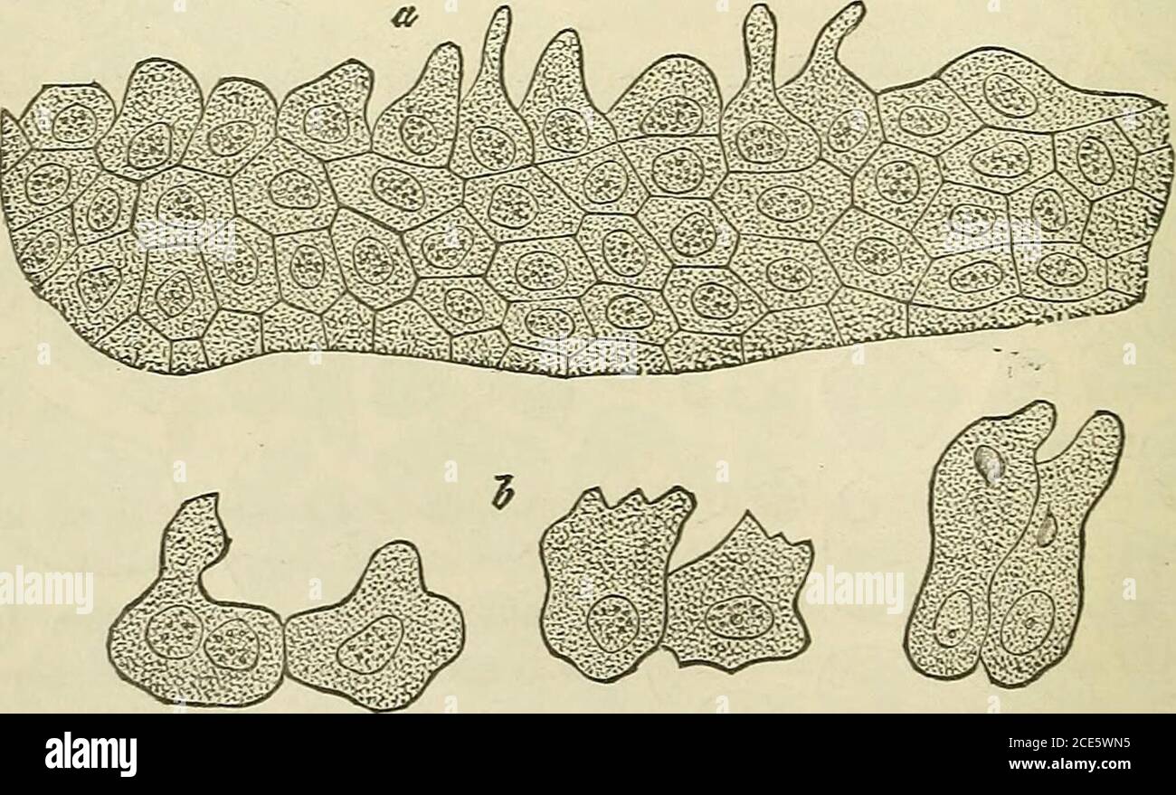 Granulation tissue hi-res stock photography and images - Alamy