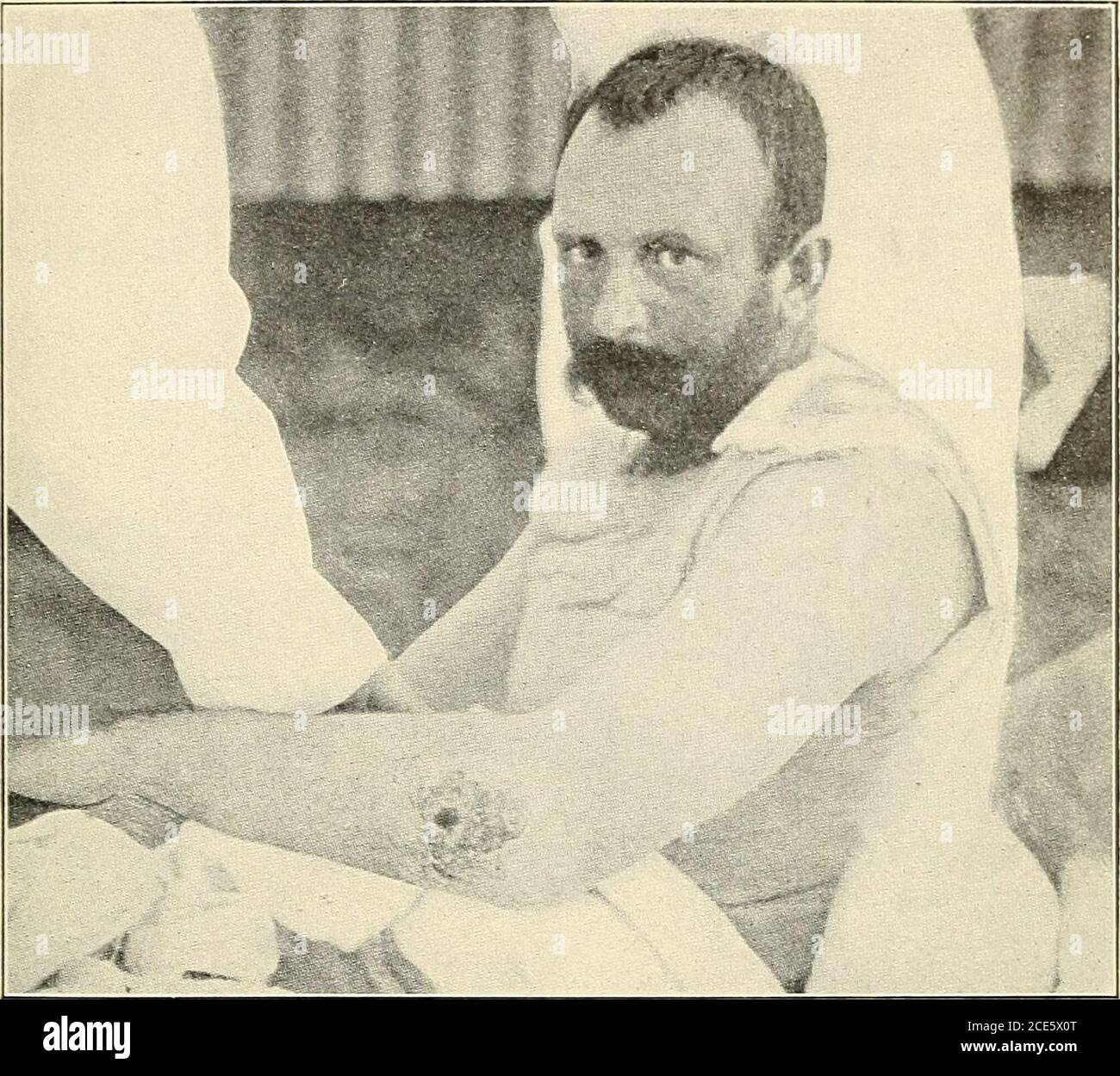 Buboes hi-res stock photography and images - Alamy